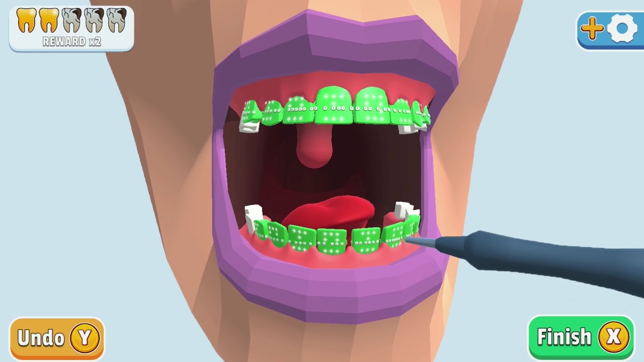 Dentist Bling: Complete Edition for Nintendo Switch - Nintendo Official ...